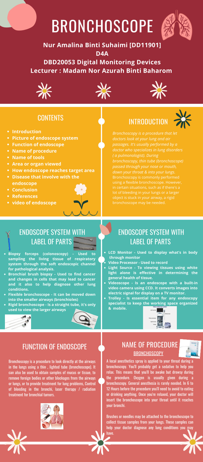 Report Infographic [Bronchoscope] by Nur Amalina - Flipsnack