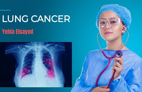 New flipbook by Yehia Elsayed - Flipsnack