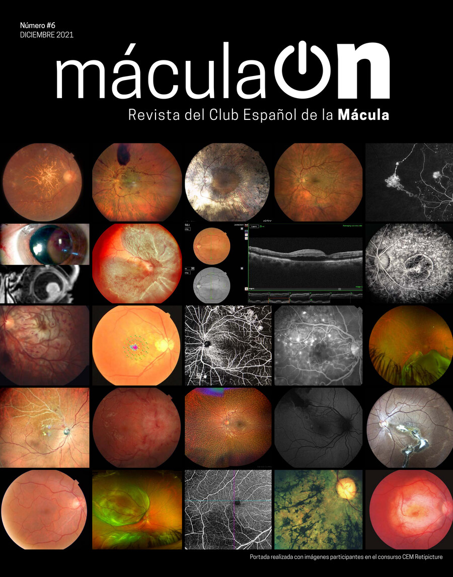 Macula_ON#06 by FUNDACION VER SALUD - Flipsnack